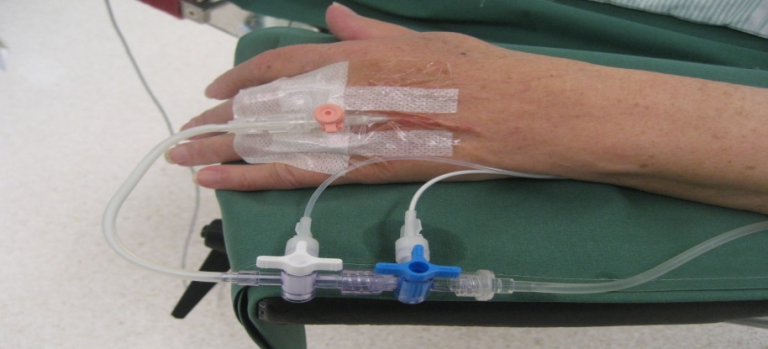 Intravenös anestesi – TIVA/TCI - Narkosguiden