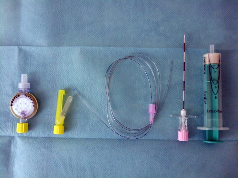 Epiduralanestesi - Narkosguiden