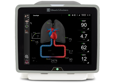Central hemodynamik: indikationer, metoder och klinisk tolkning ...