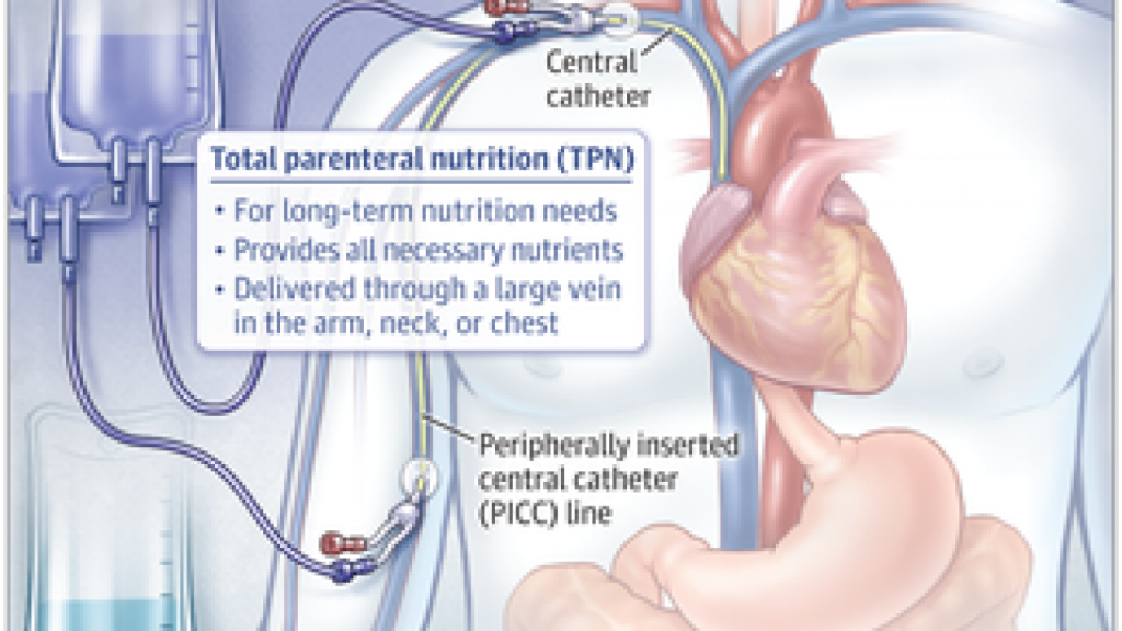 Nutrition - allmänt - Narkosguiden