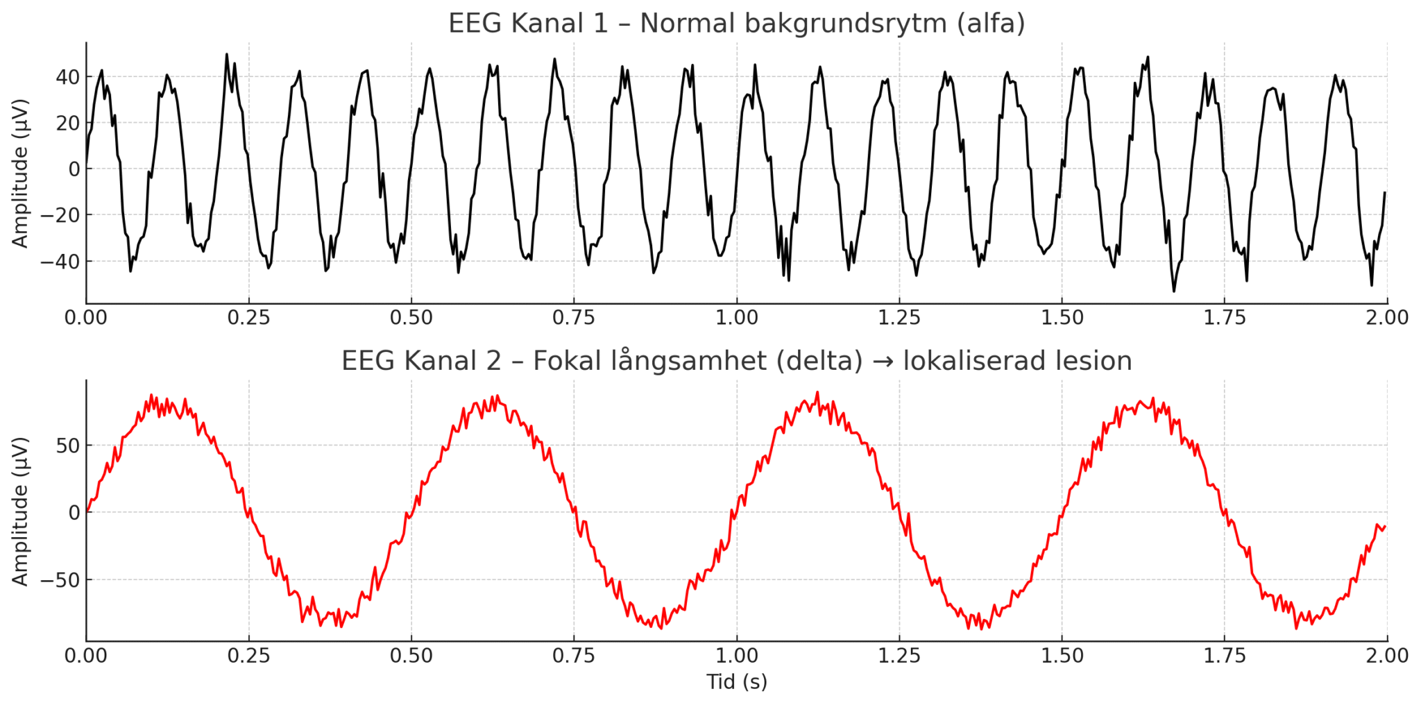 EEG – Elektroencefalografi: Indikationer, tolkning och klinisk ...
